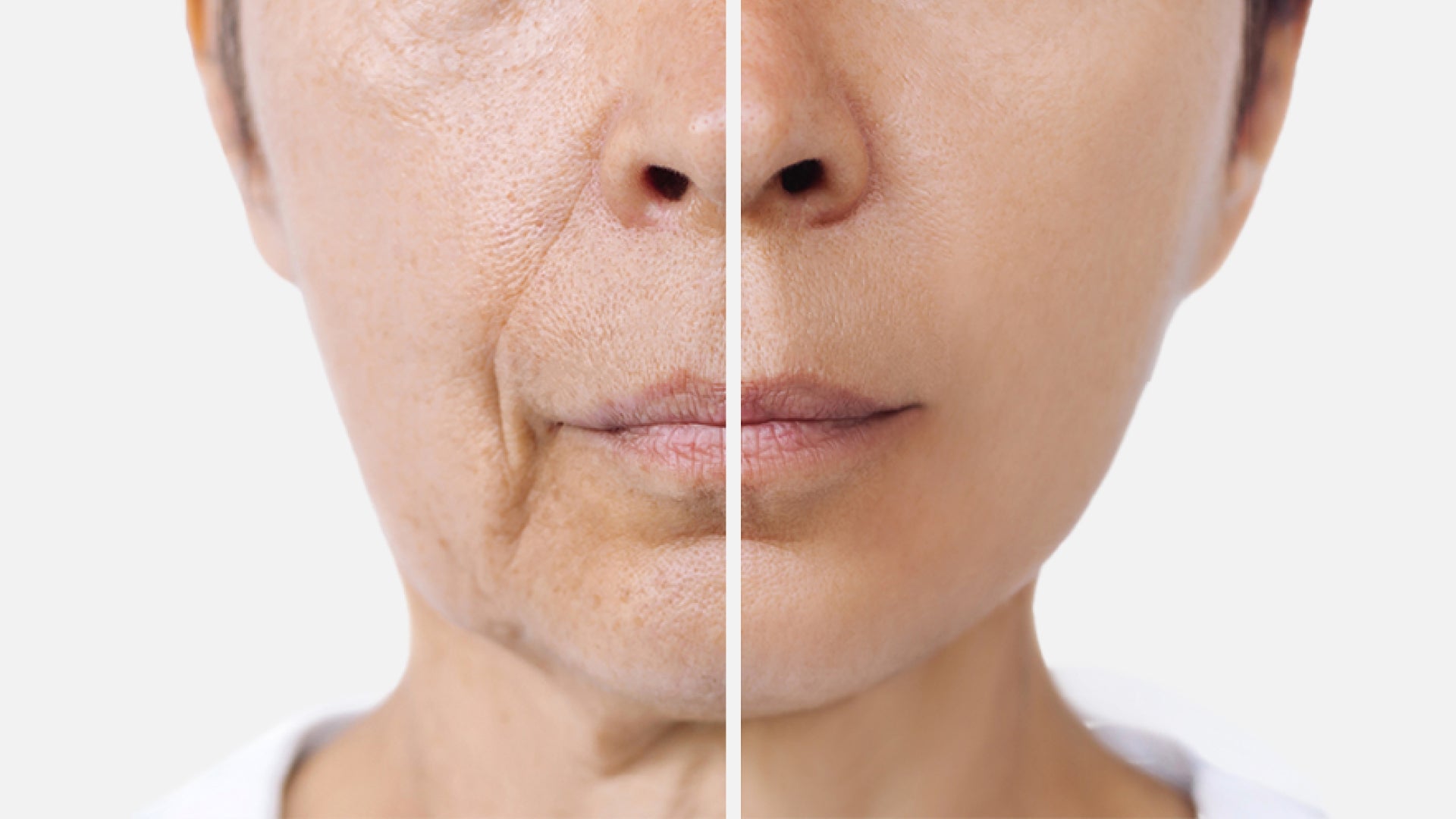 The Science Behind Skin Aging: Causes and Solutions – RegenSkin LLC